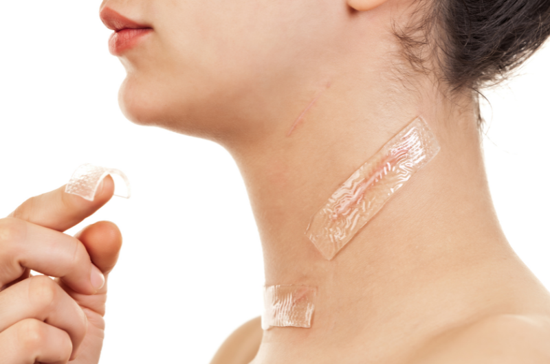 Scar Tissue After Dog Bite: Recovery and Compensation